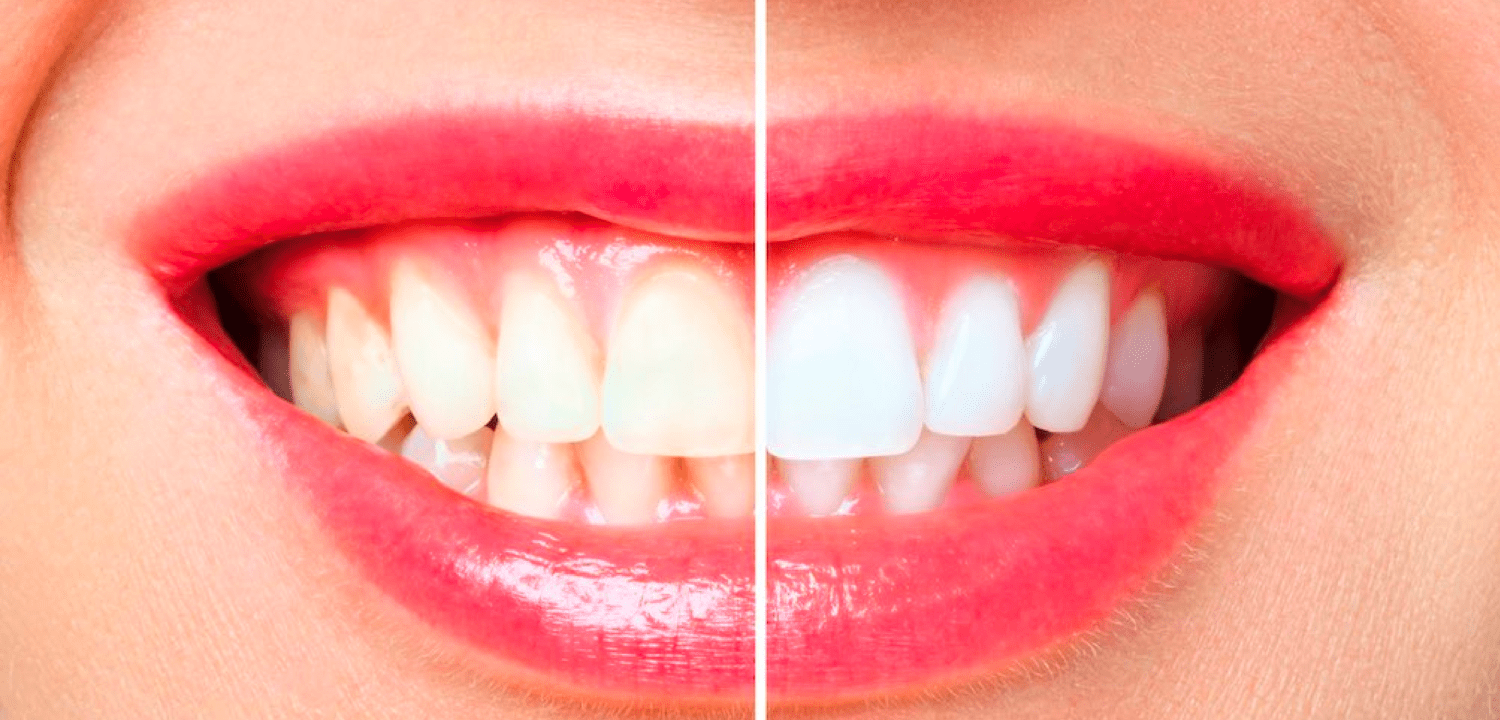 Clínicas Odontológicas Sonría | El poder de sonreír