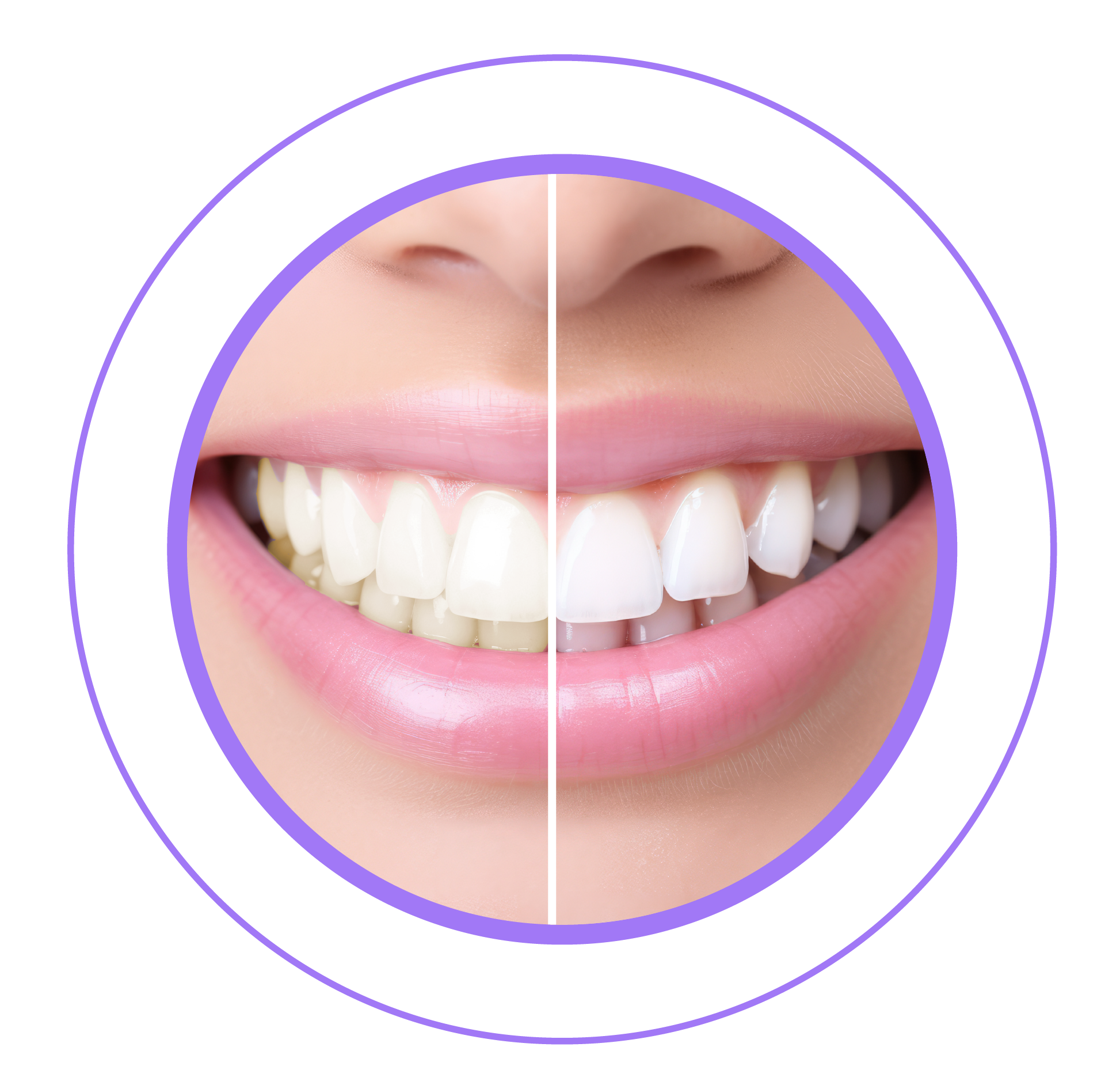 Clínicas Odontológicas Sonría | El Poder de Sonreír